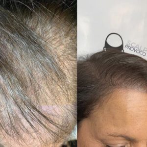 Female SMP Hair Treatment | London - Sian Dellar