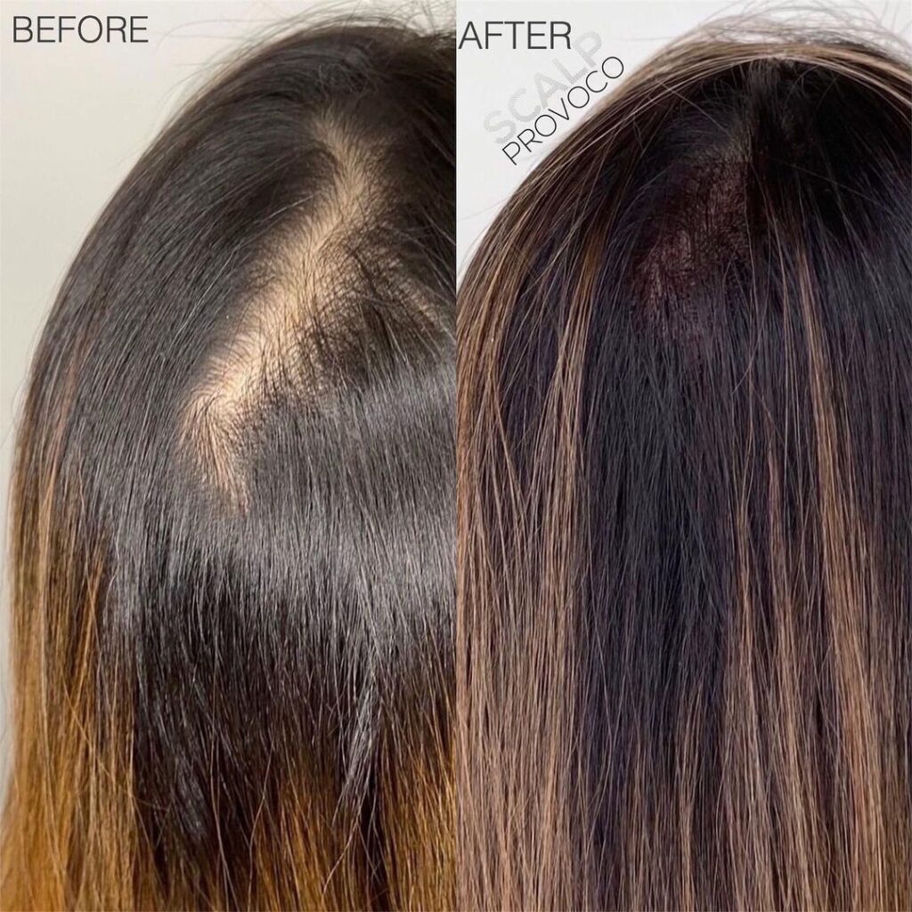 Female SMP Hair Treatment | London - Sian Dellar
