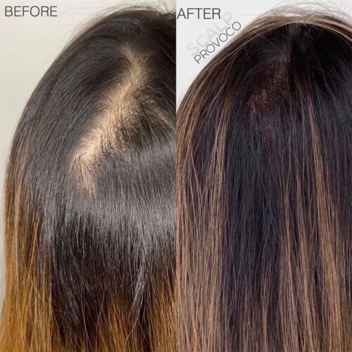 Female SMP Hair Treatment | London - Sian Dellar