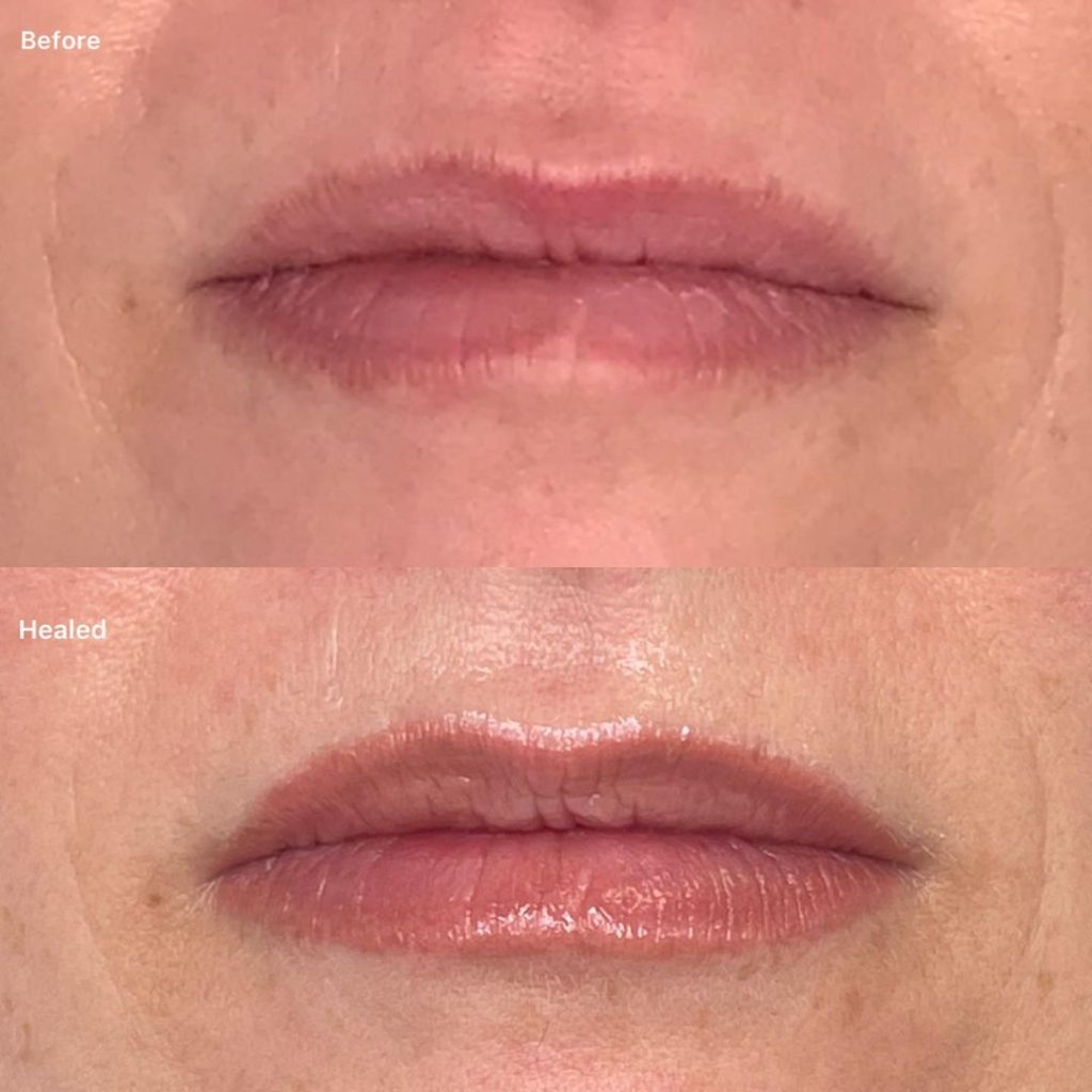 Subtle lip enhancement for a natural look - Sian Dellar