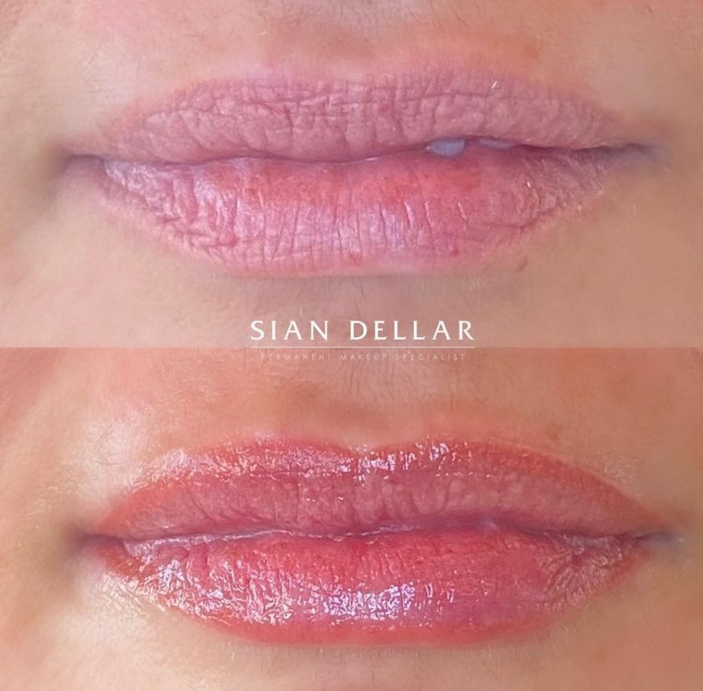Tired looking lips to an instant youthful boost - Sian Dellar